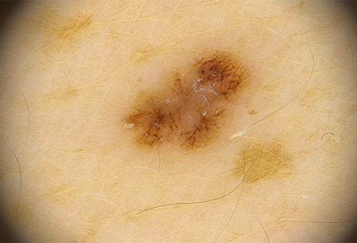 Dr. Martha Humer – Hautärztin